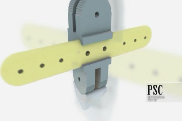 Spinal Cord Protection | Indiegogo