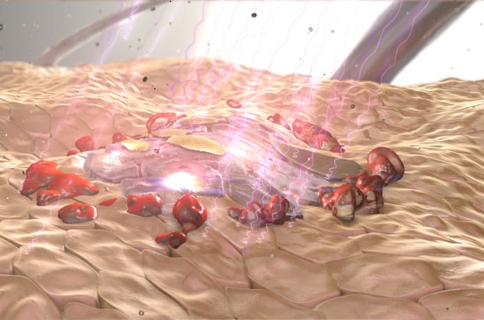 How cancer develops: detailed animation | Indiegogo