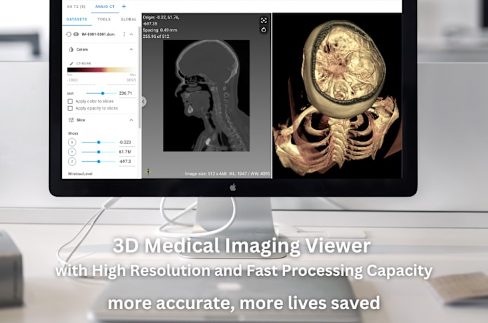 3D Medical Imaging Viewer for Accurate Diagnoses | Indiegogo