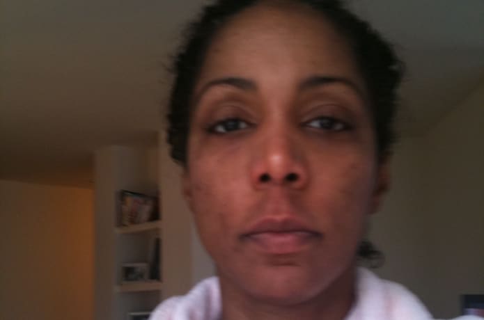 FORMER QVC TOP MODEL BATTLES TOXIC INJURY | Indiegogo